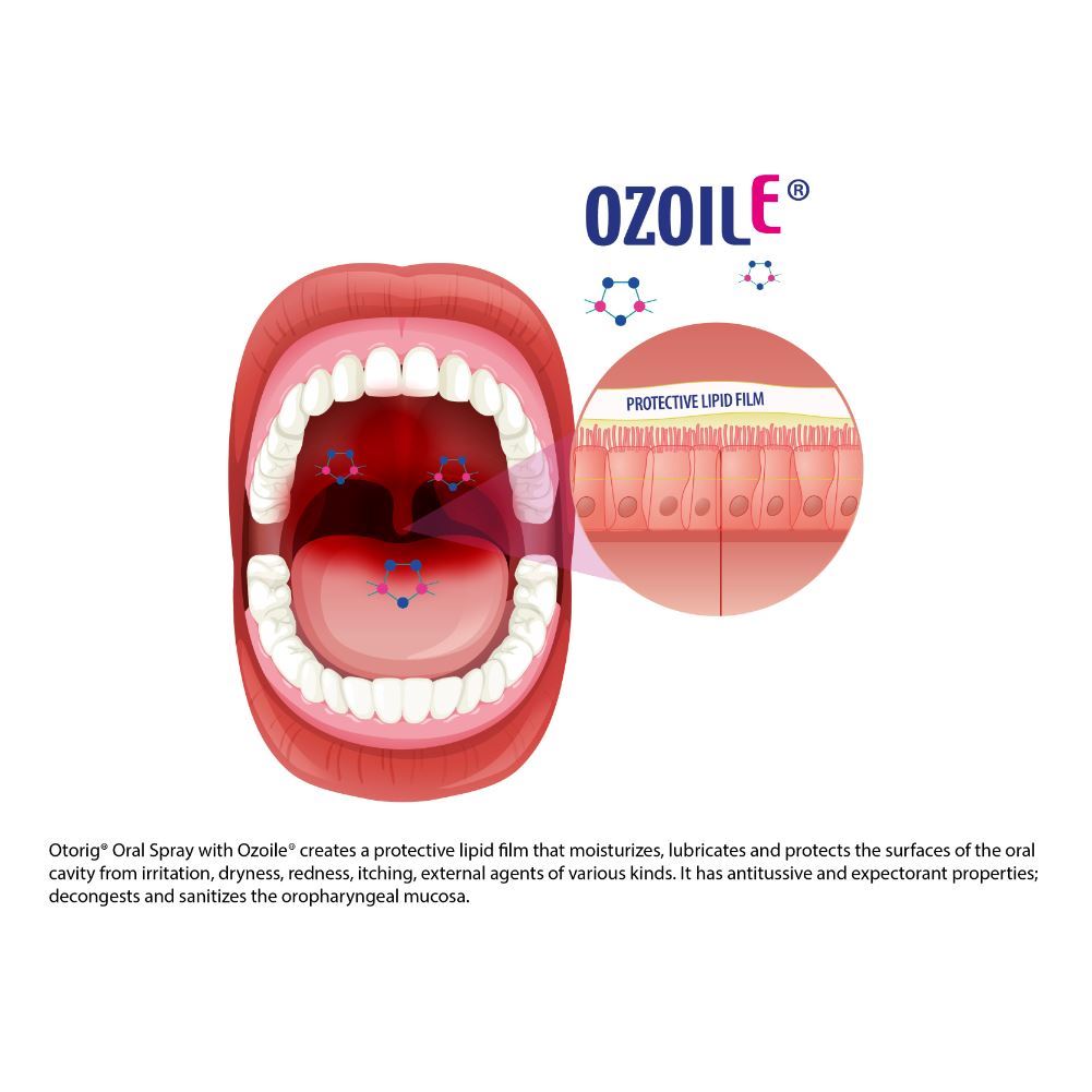 EuroPharma | Otorig Oral Spray Medical Device