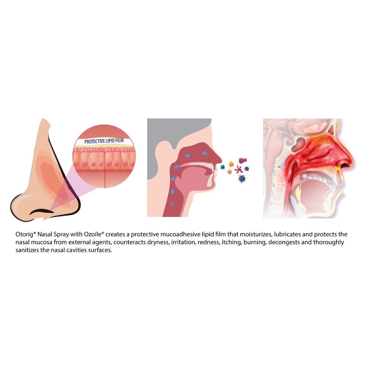 EuroPharma | Otorig Nasal Spray Medical Device